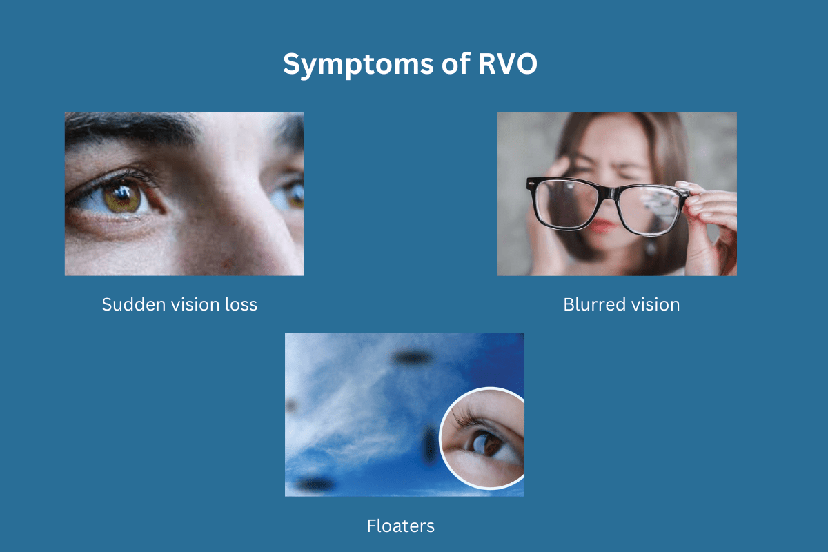 Treating Retinal Vein Occlusion Through Eye Injections