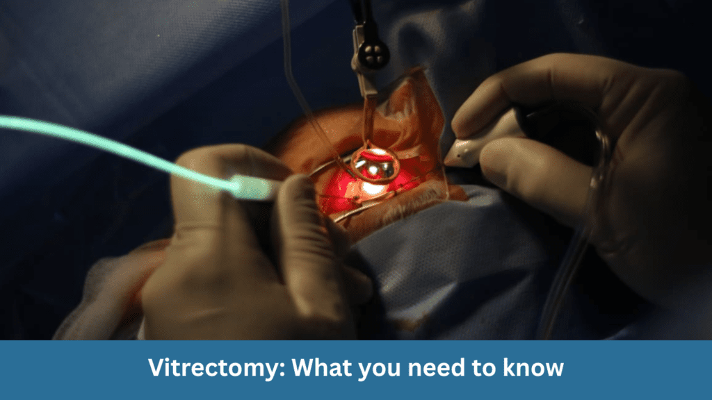Vitrectomy Surgery: What You Need to Know
